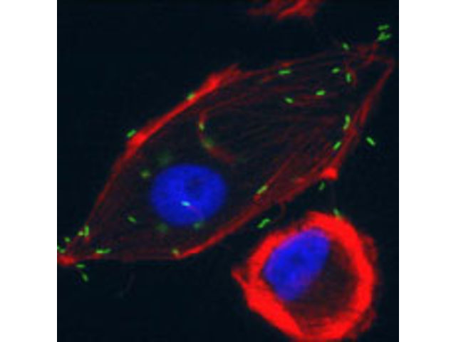 Z-axis lens positioning : Imaging-Software : MetaMorph | Contact ...